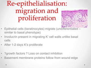 Cutaneous wound healing: plastic surgery departmental teaching | PPTX