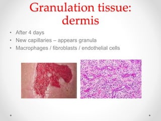 Cutaneous wound healing: plastic surgery departmental teaching | PPTX
