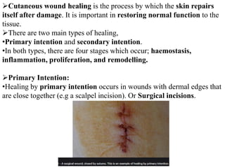 Wound Healing Primary Intention