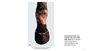 Wound healing (repair) | PPTX