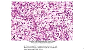 Wound healing (repair) | PPTX