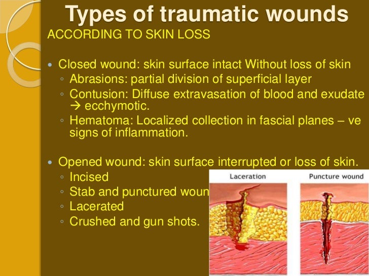 Wound healings