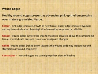 Wound repair | PPT