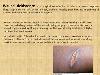 Wound repair | PPT