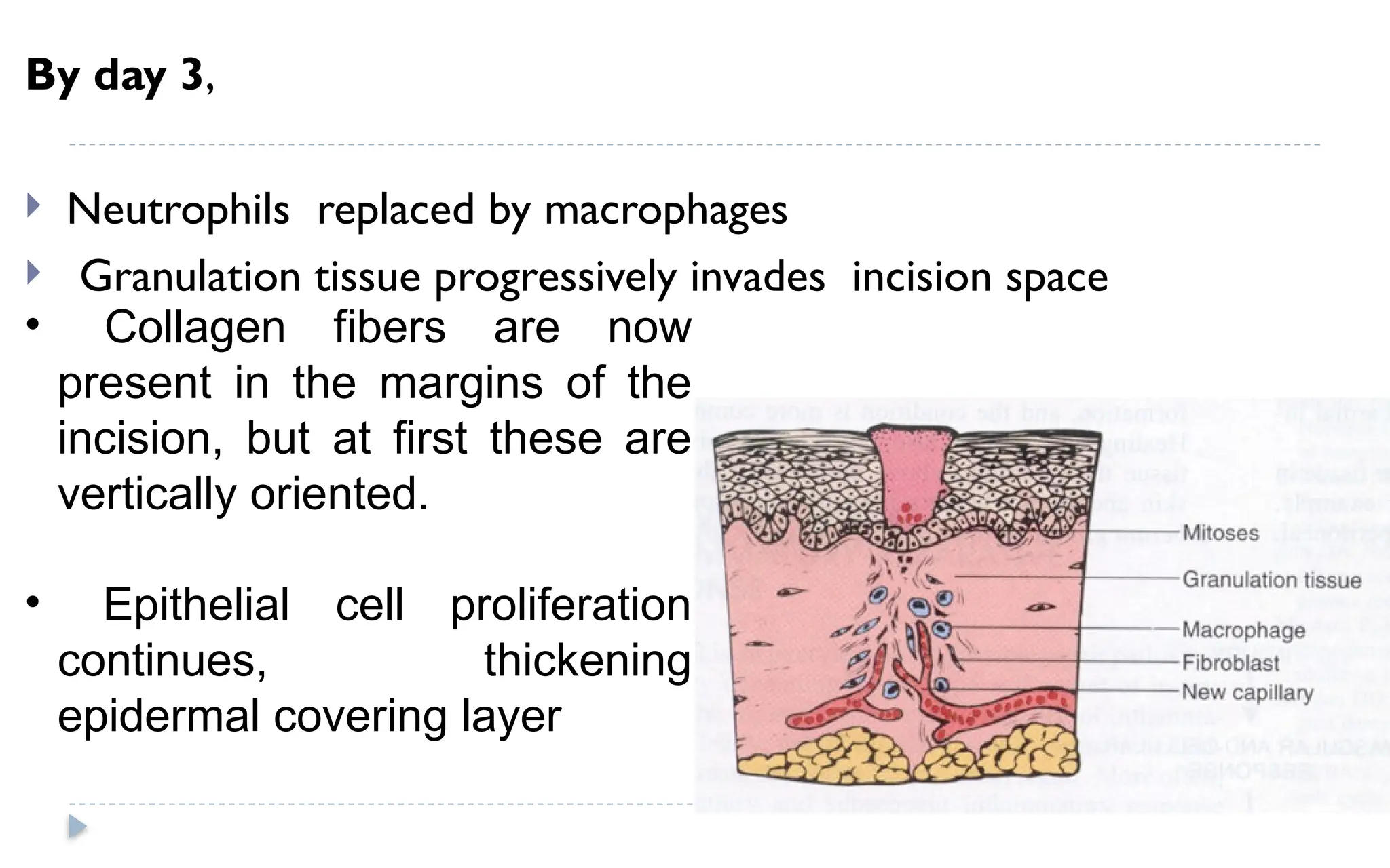 wound healing and types of wound healing and soft tissue and hardtissue ...