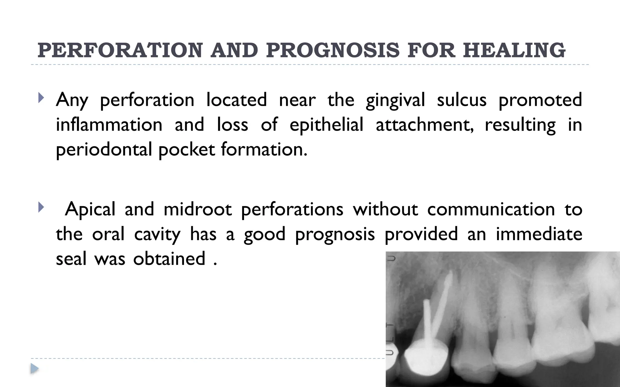 wound healing and types of wound healing and soft tissue and hardtissue ...