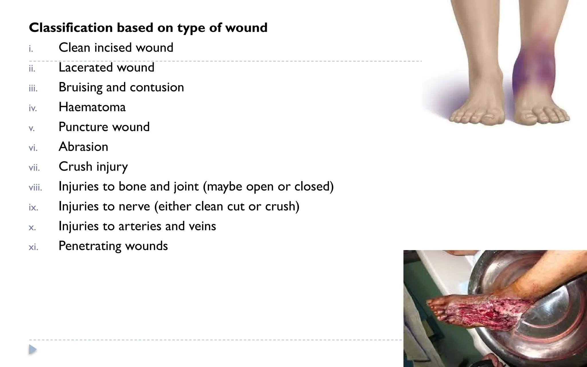 wound healing and types of wound healing and soft tissue and hardtissue ...