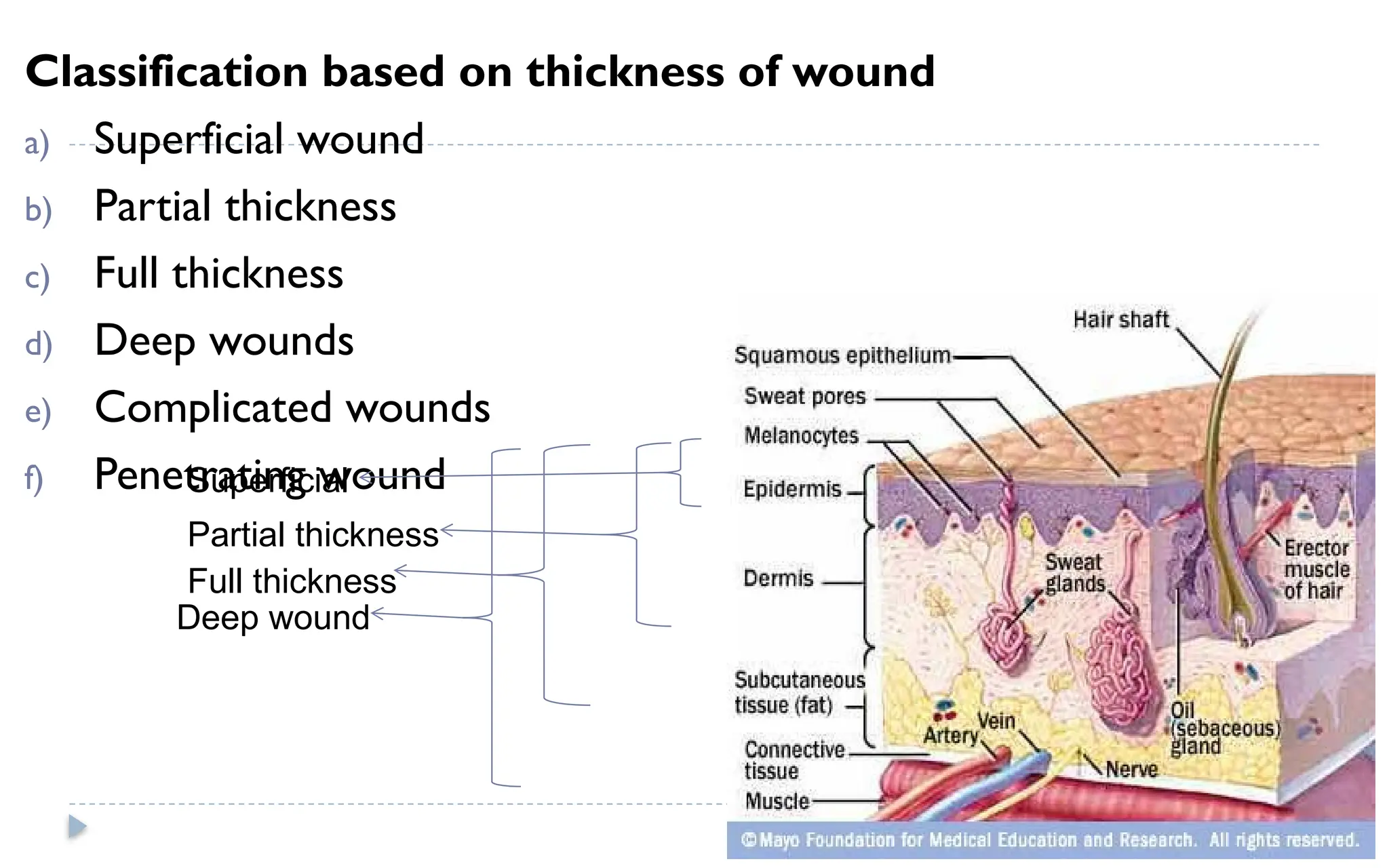 wound healing and types of wound healing and soft tissue and hardtissue ...