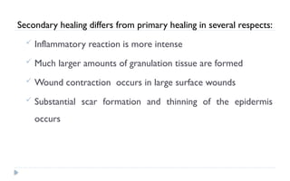 wound healing and types of wound healing and soft tissue and hardtissue ...
