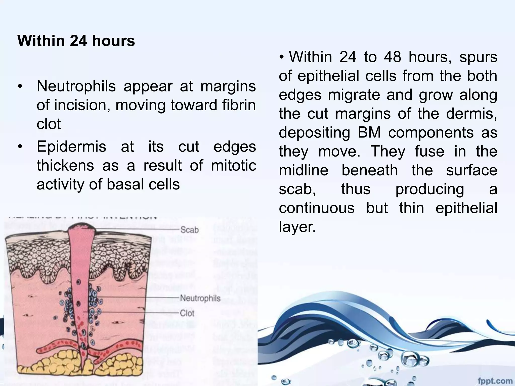 Wound healing | PPTX
