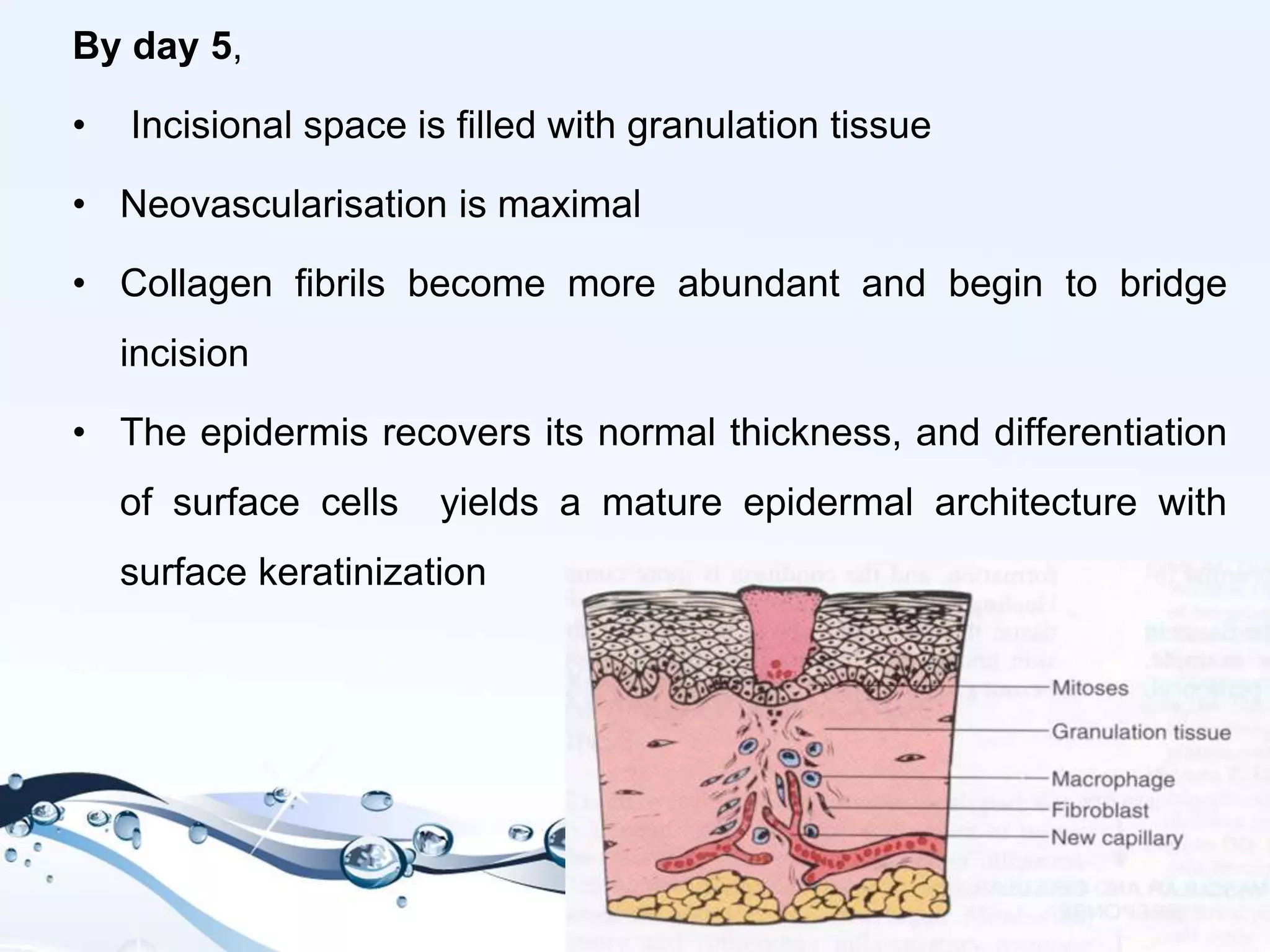 Wound healing | PPTX