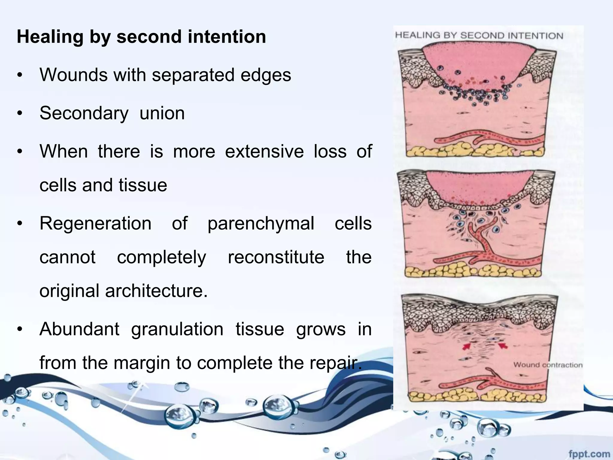 Wound healing | PPTX