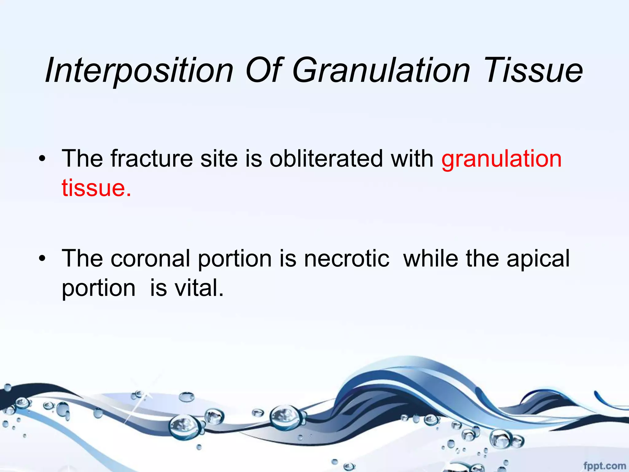 Wound healing | PPTX