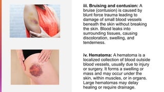 Wound Healing BSC Nursing 3rd semester Power point | PPTX