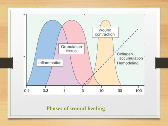 Wound healing and sterilization for MBBS students | PPT | First Aid ...