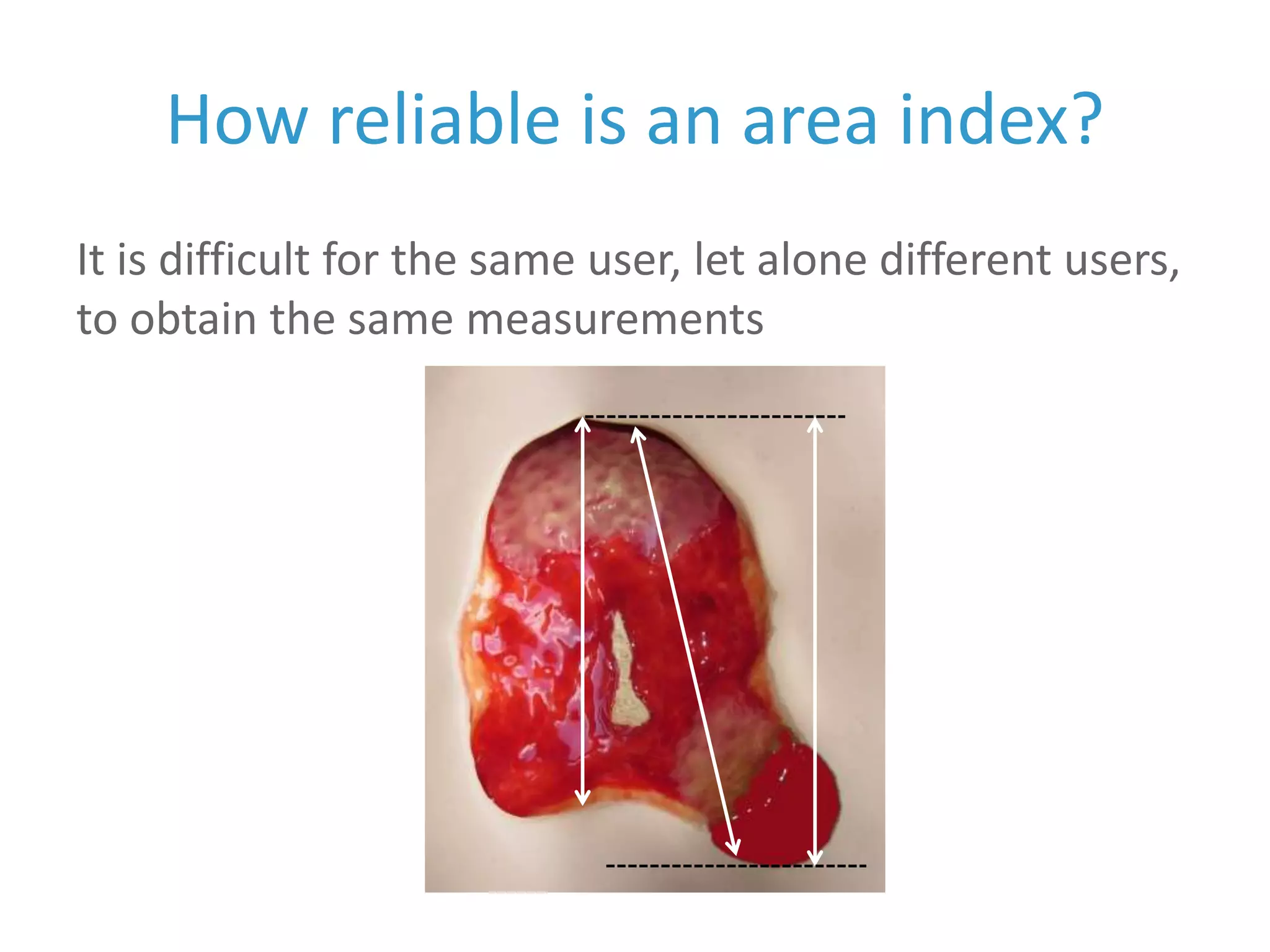 Wound imaging and measurement for clinical research and clinical ...