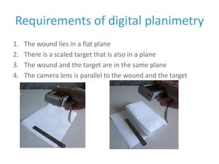Wound imaging and measurement for clinical research and clinical ...