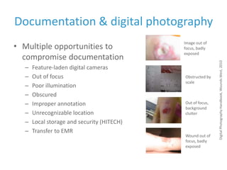 Wound imaging and measurement for clinical research and clinical ...