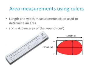 Wound imaging and measurement for clinical research and clinical ...