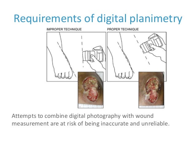 Wound imaging and measurement for clinical research and clinical prac…