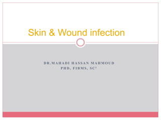 Wound infection ppt Dr.Mahadi | PPT