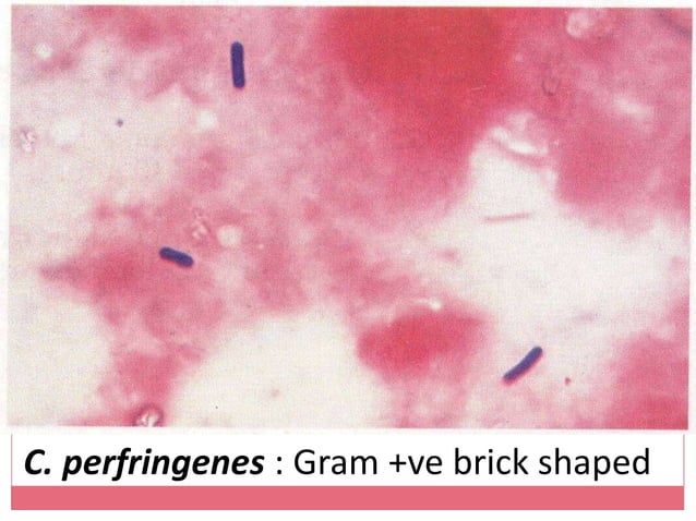 Wound infection ppt Dr.Mahadi | PPT