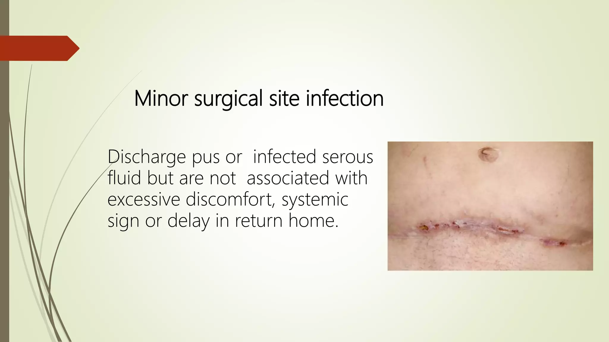 Wound infection | PPTX