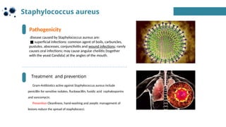 wound infection akram zaki for study.pptx