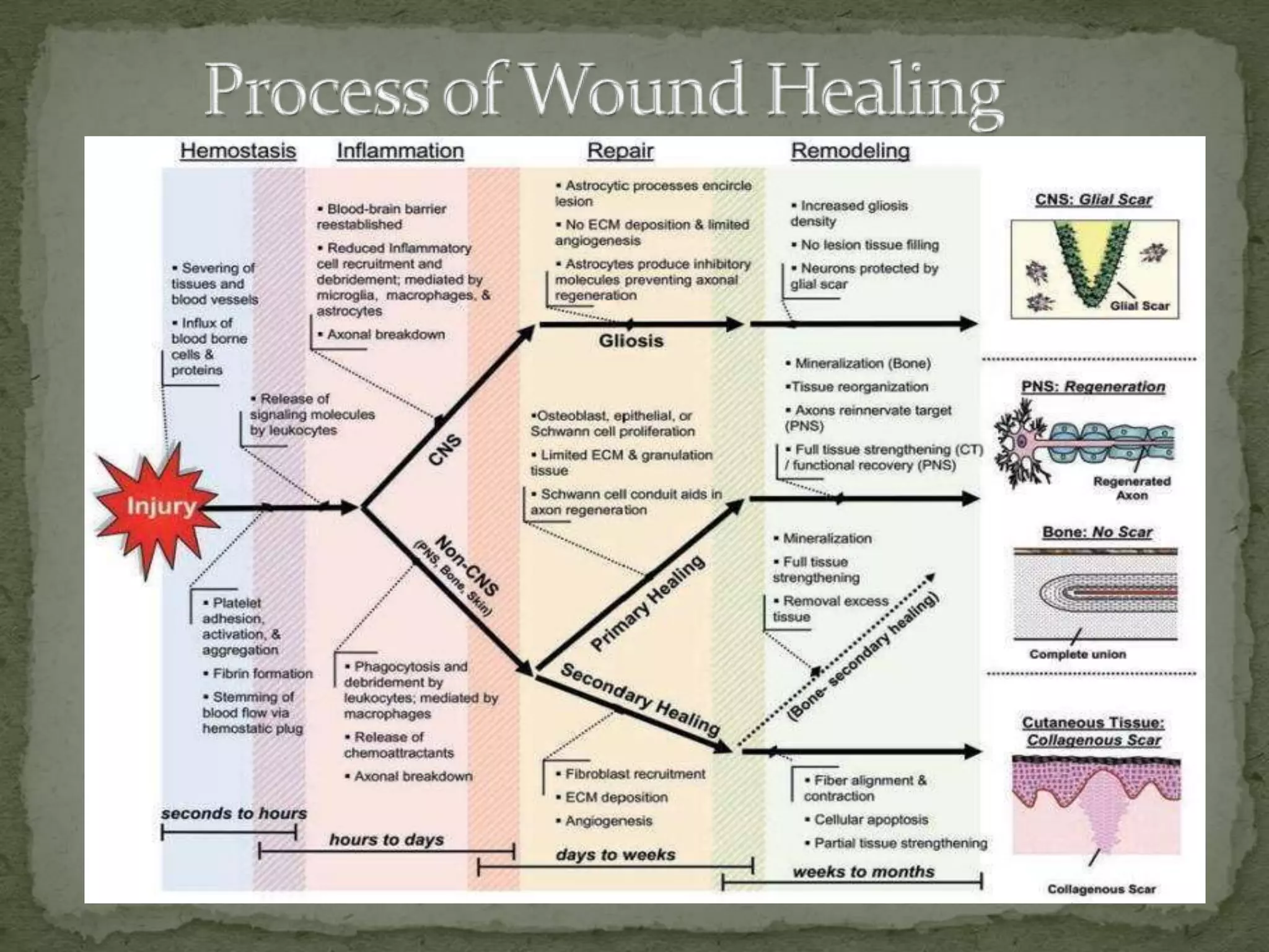 Wound infection (revised 27th feb 2017) | PPTX