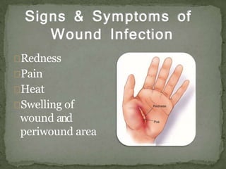 Wound infection (revised 27th feb 2017) | PPTX