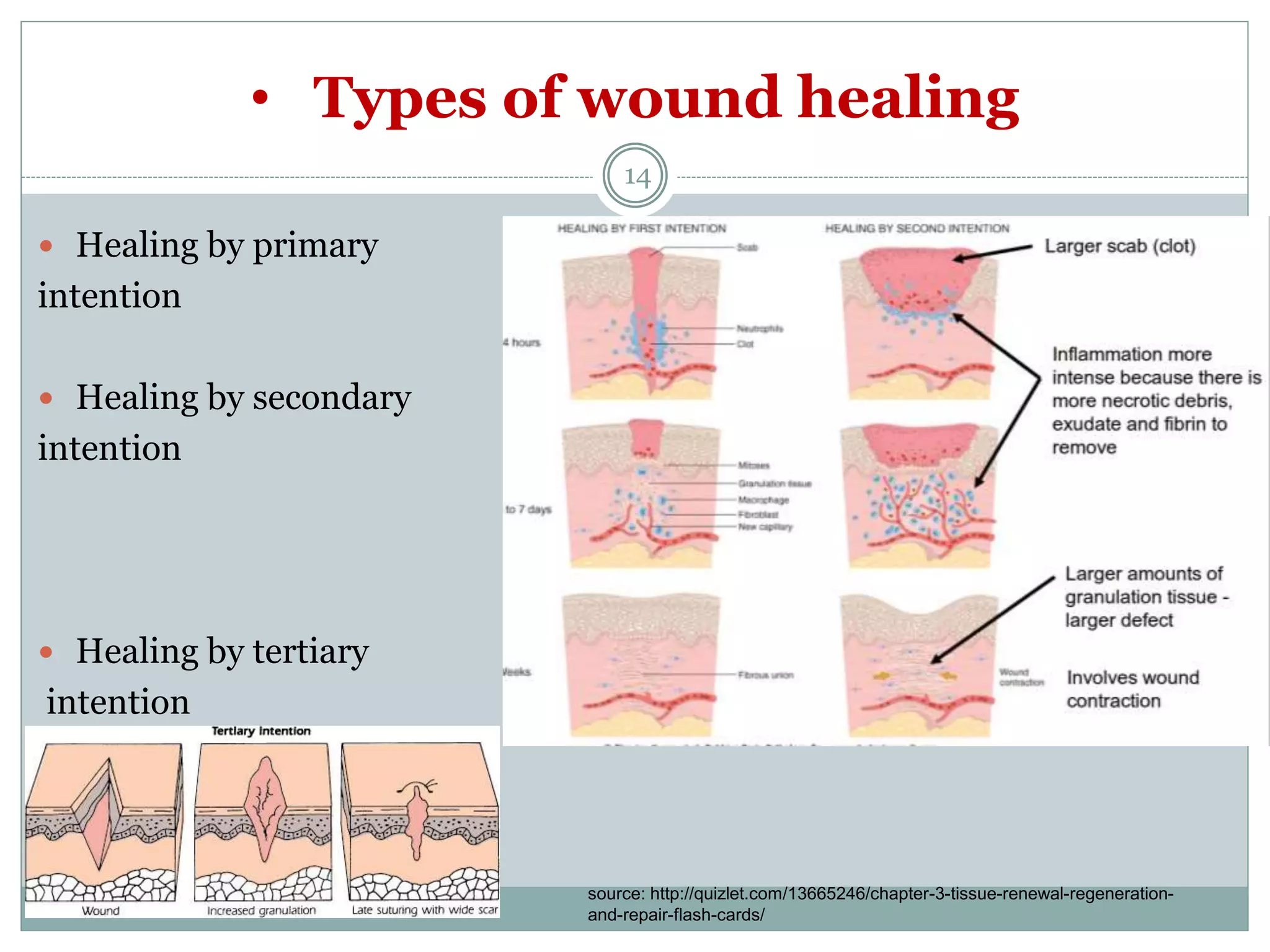 Information on Wound | PPTX | First Aid | Injuries