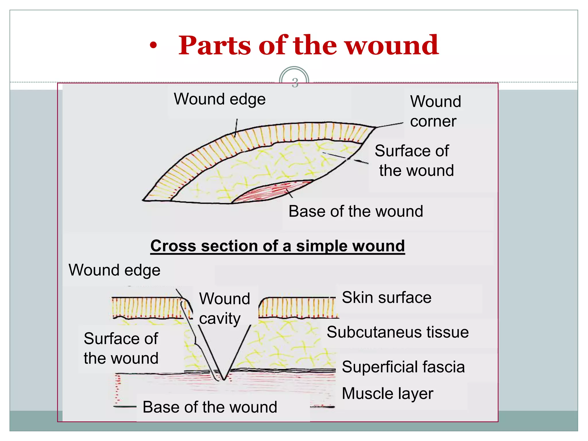 Information on Wound | PPTX | First Aid | Injuries