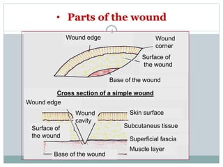 Information on Wound | PPTX | First Aid | Injuries