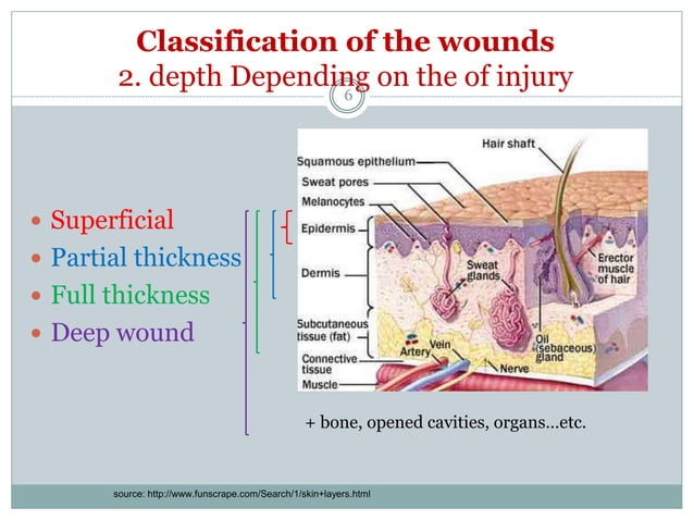 Information on Wound | PPTX | First Aid | Injuries