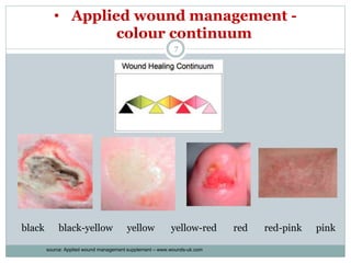 Information on Wound | PPTX | First Aid | Injuries