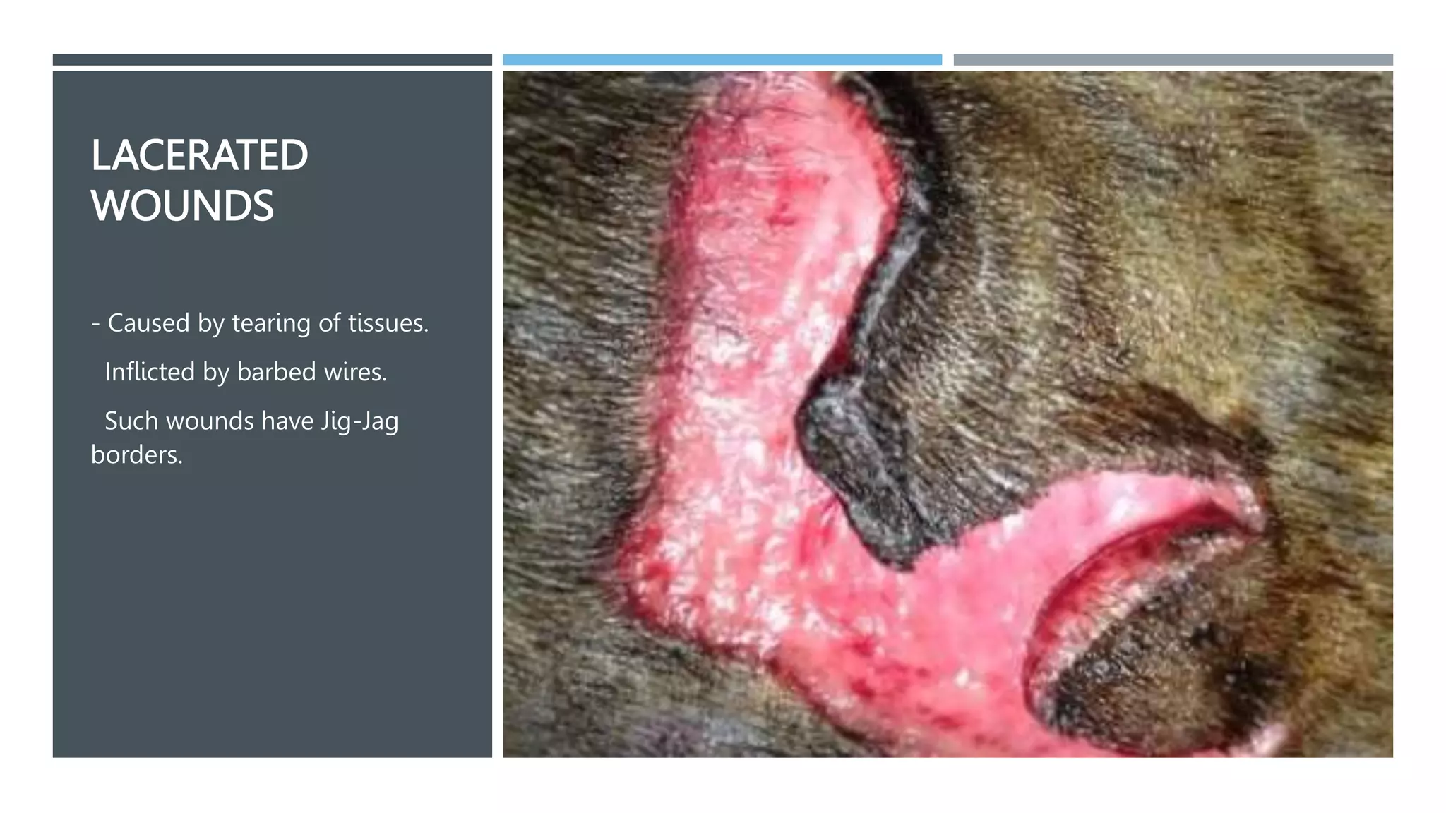 Wound & its management.pptx