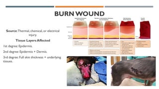 Wound its types-1.pptx small animal surgery topic for dvm students | PPTX