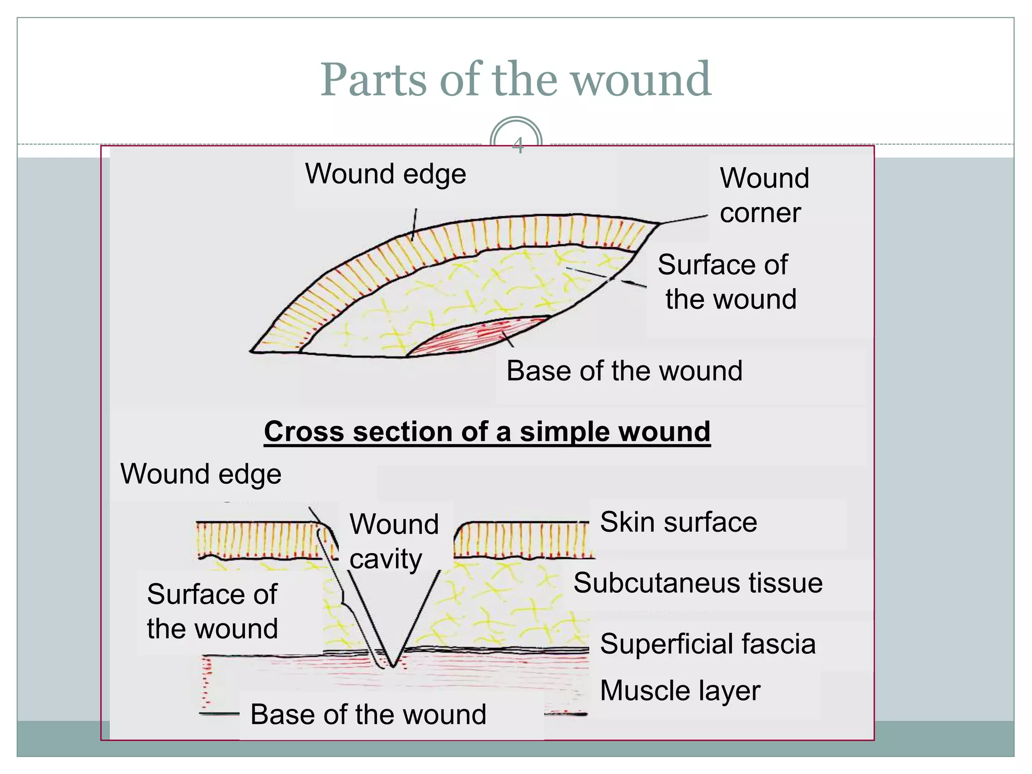 Wound lecture 1.ppt