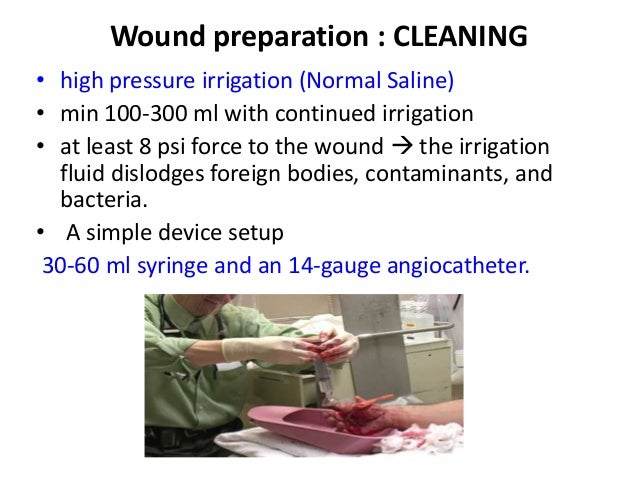Wound management