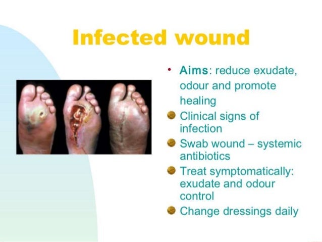 Wound management