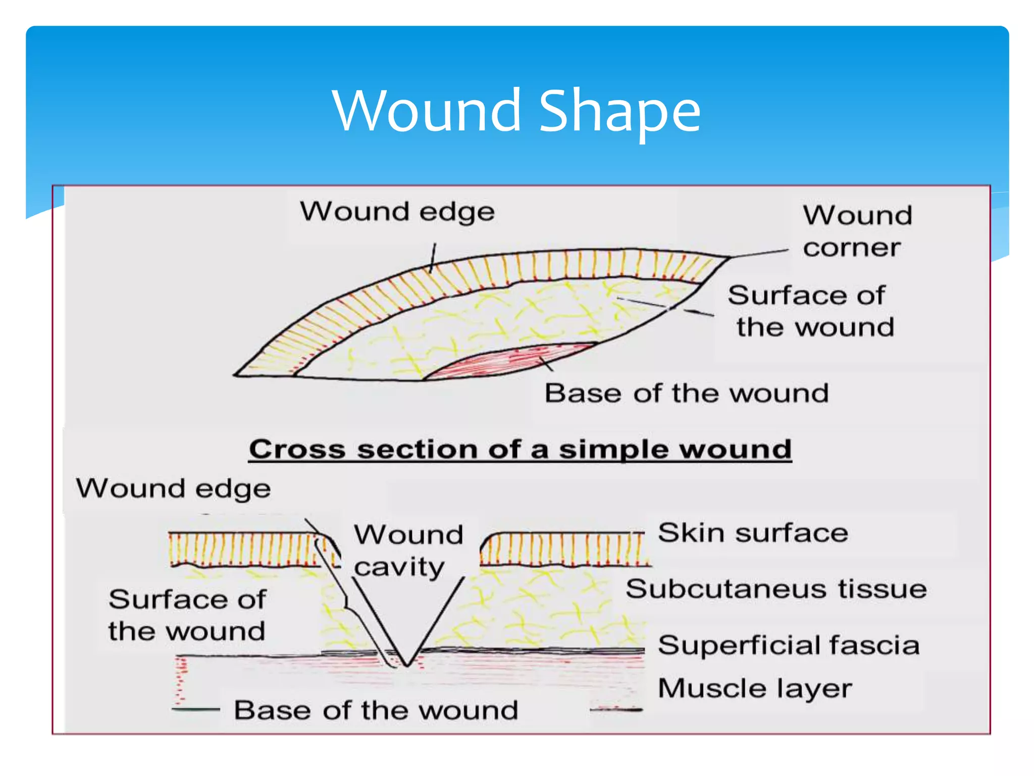 Wound management | PPTX