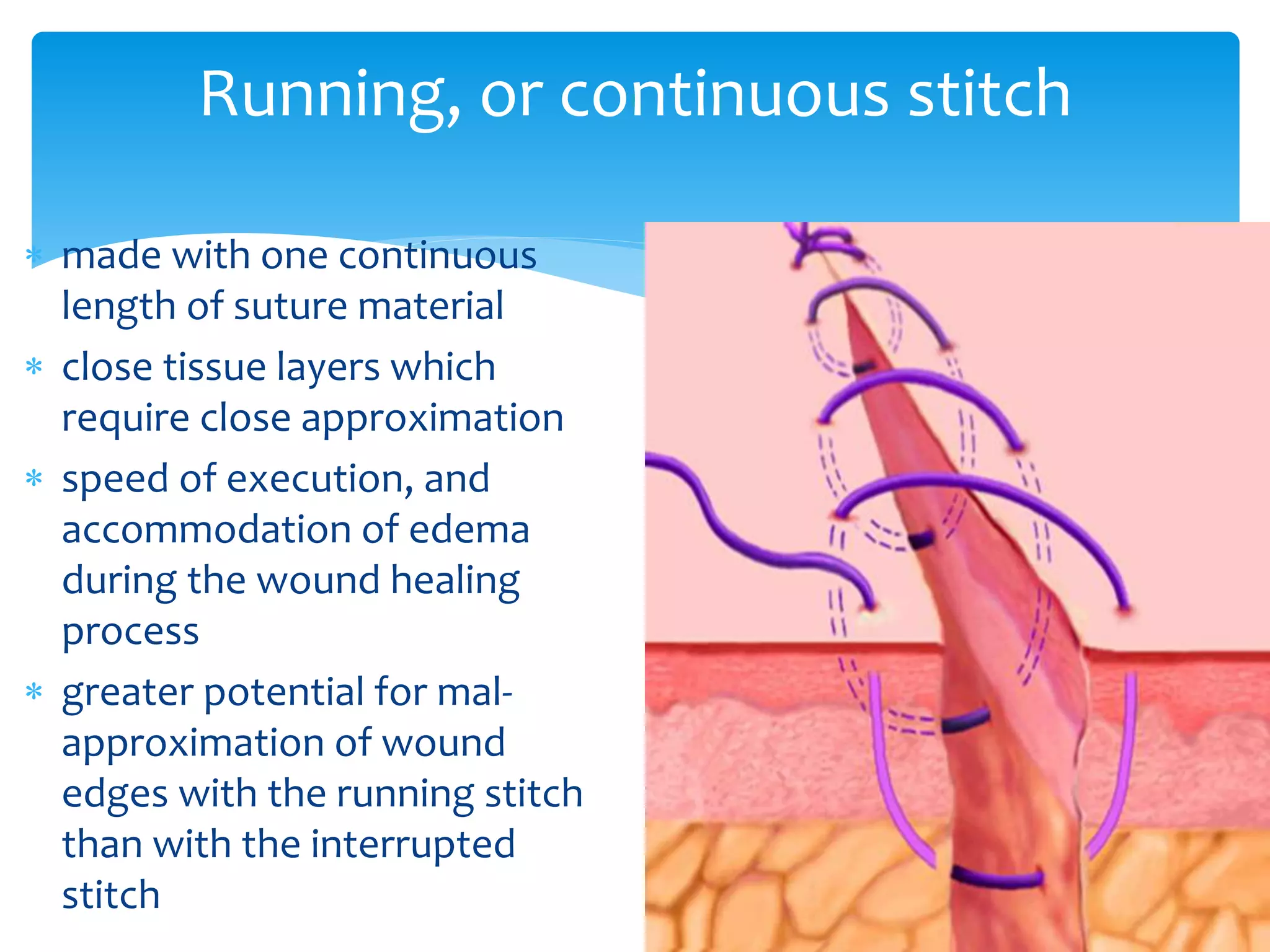 Wound management | PPTX