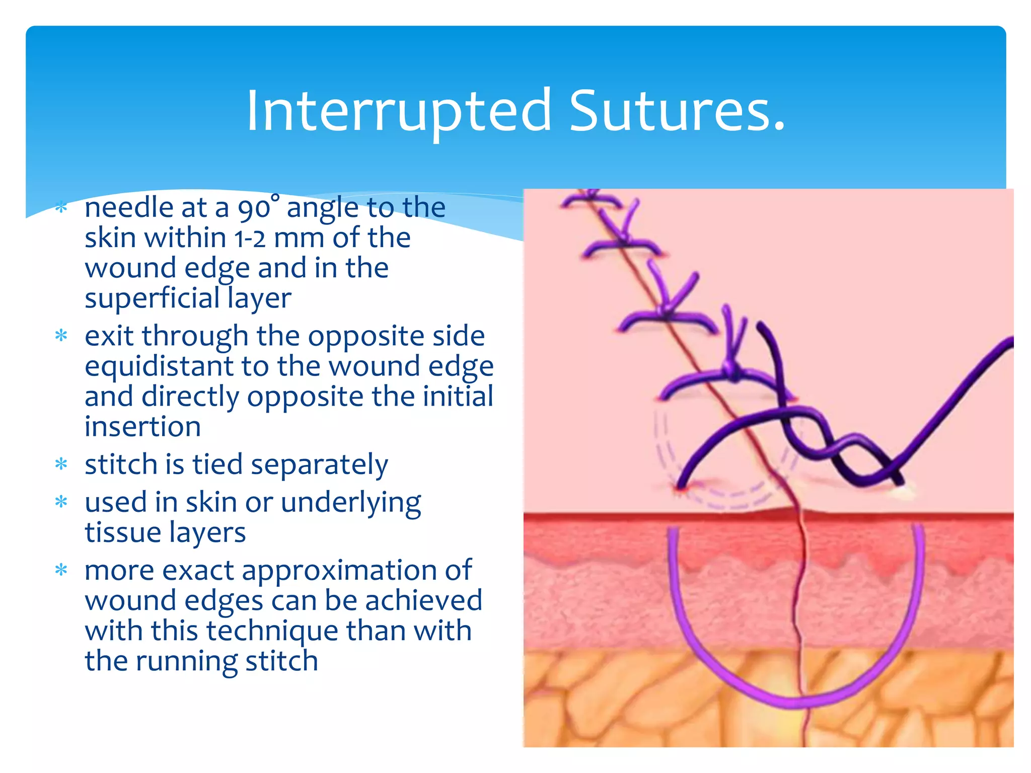 Wound management | PPTX