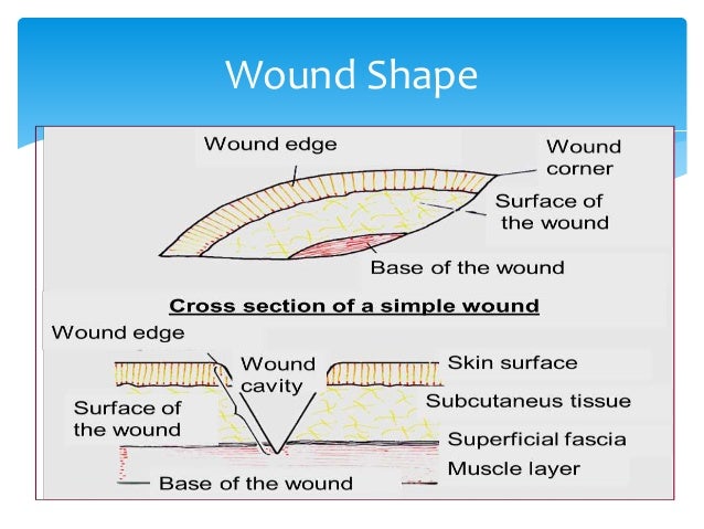 Wound management