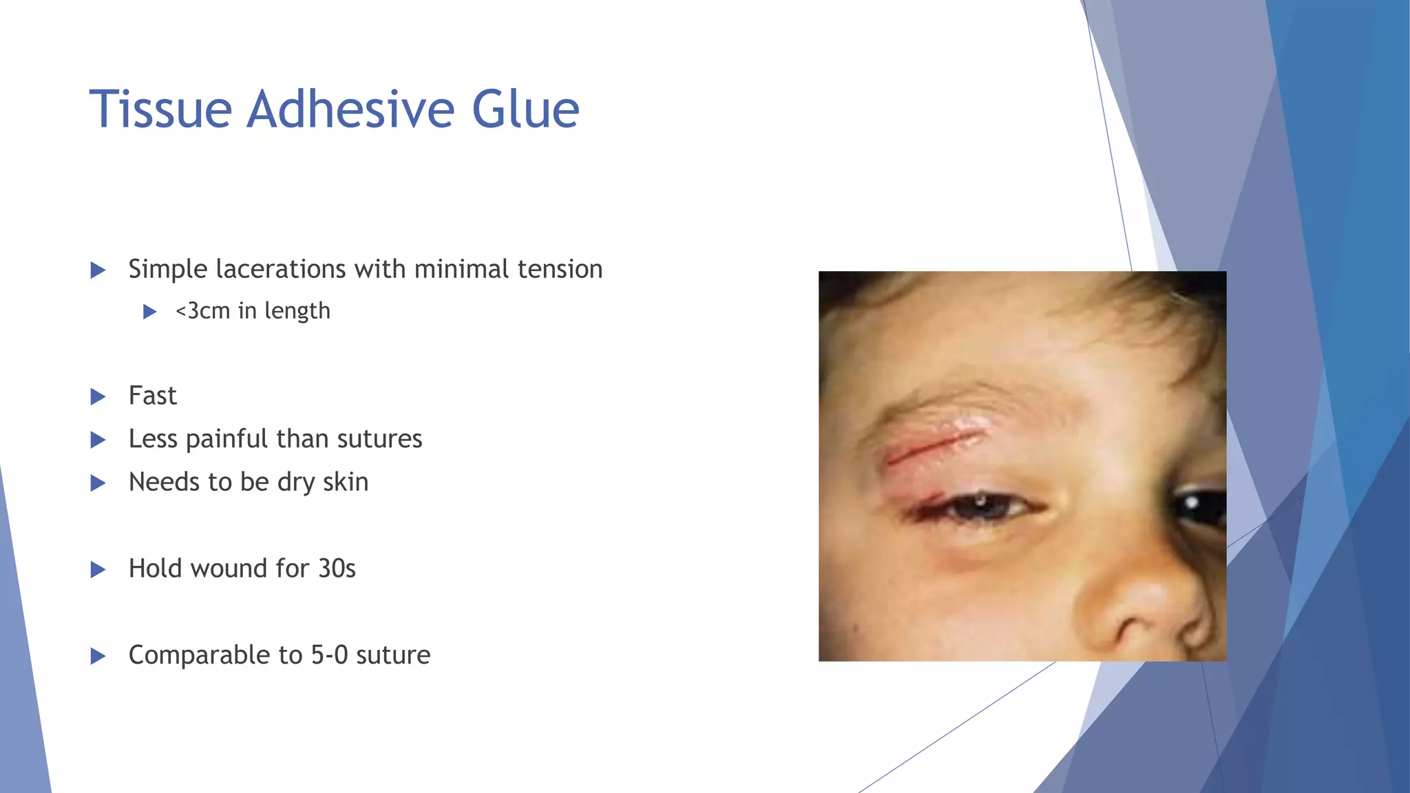 Wound management | PPTX