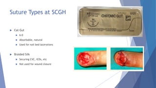 Wound management | PPTX