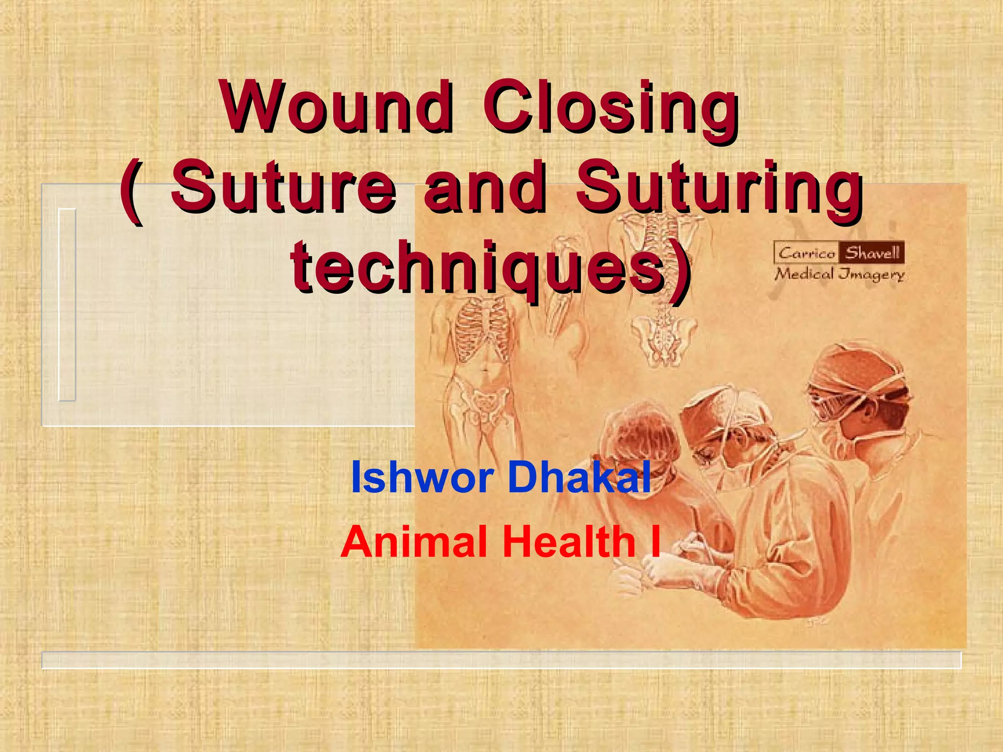 Wound management | PPT