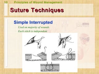 Wound management | PPT