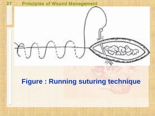 Wound management | PPT