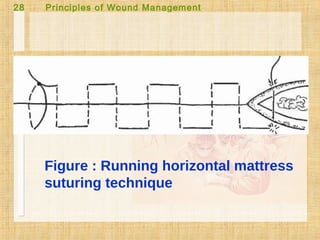 Wound management | PPT